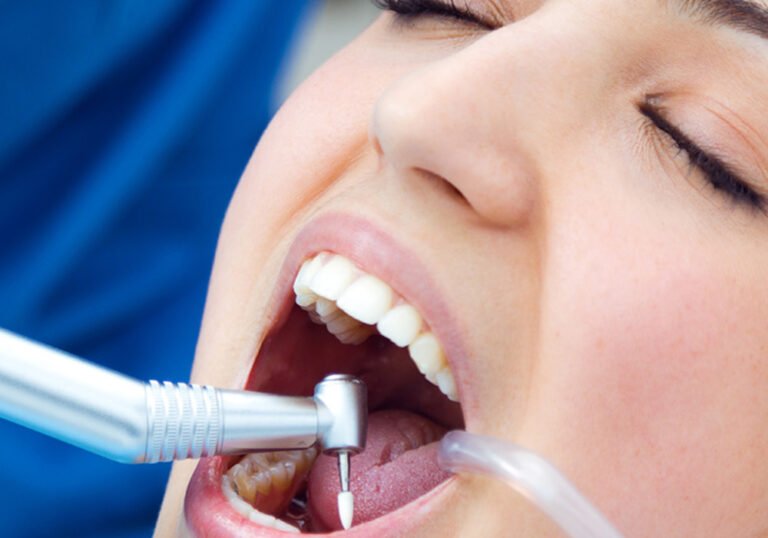 Dental Implant Bayswater | The Good Dentists Group